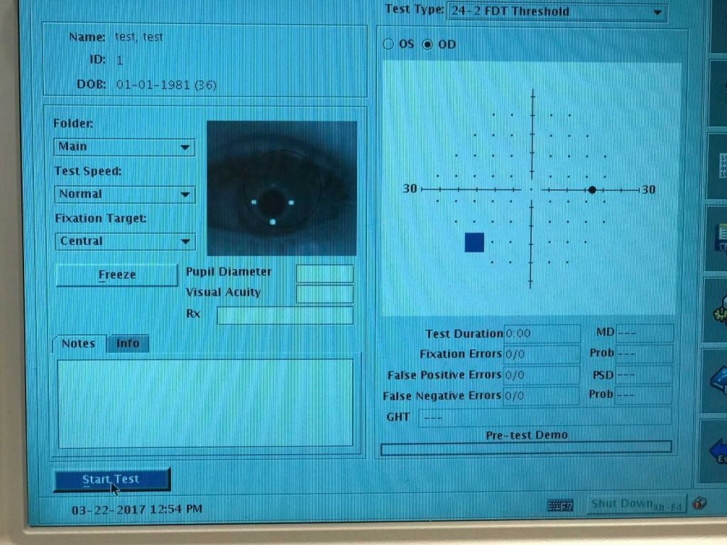 CARL ZEISS Humphrey Matrix 715 Visual Field Analyzer - Nava Ophthalmic
