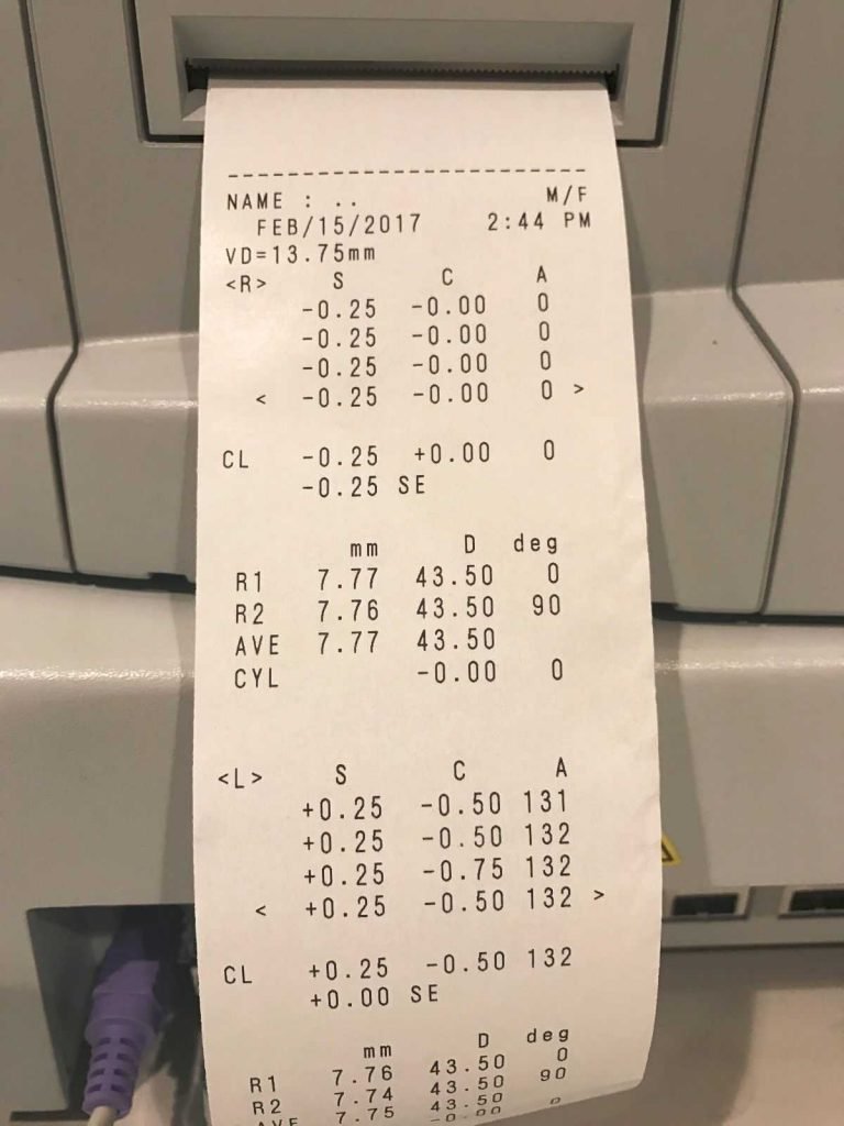 Nidek OPD-Scan II ARK 10000 Autorefractor Topographer - Nava Ophthalmic