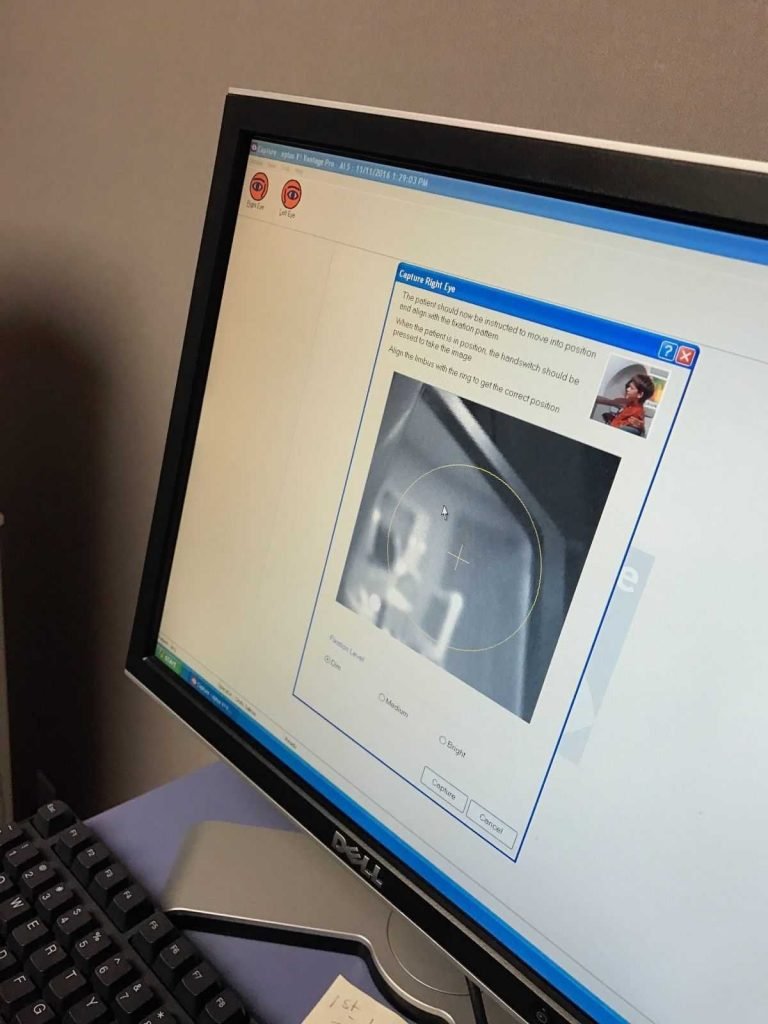 Optos P200Dx Digital Retina Imaging System - Nava Ophthalmic