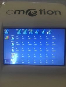 Briot Emotion Patternless Edging System - Nava Ophthalmic