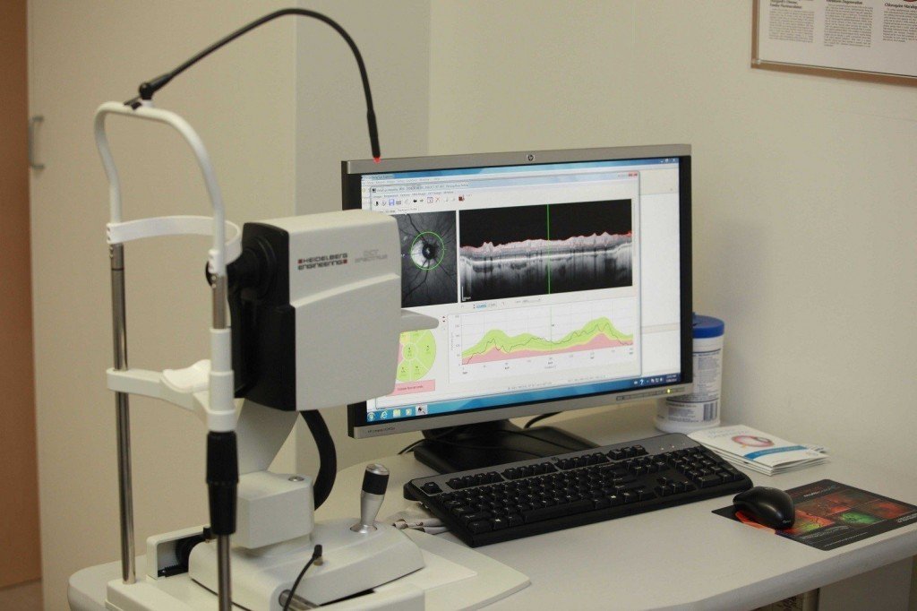 Heidelberg Spectralis HRA + OCT - Nava Ophthalmic