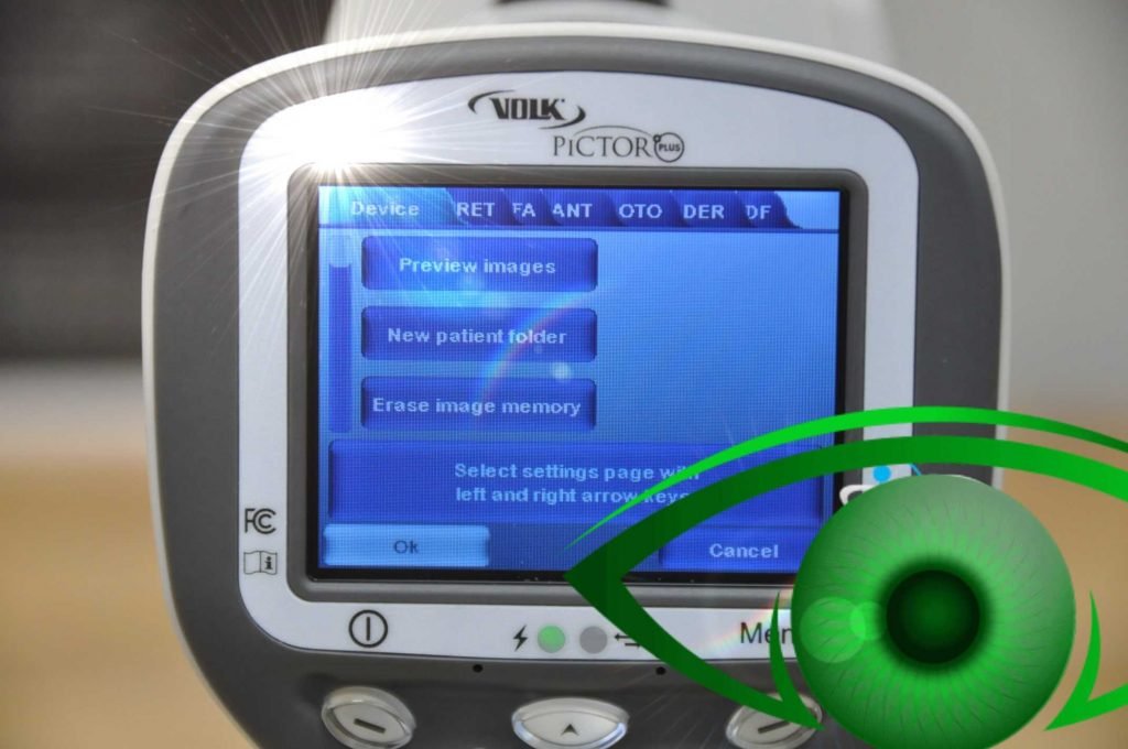 Volk Pictor Plus Portable Retinal Camera - Nava Ophthalmic
