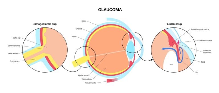 Digital Retinal Imaging: A Comprehensive Guide to Advanced Eye Care ...