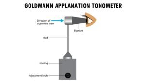 Types of Home Tonometers: A Comparative Guide